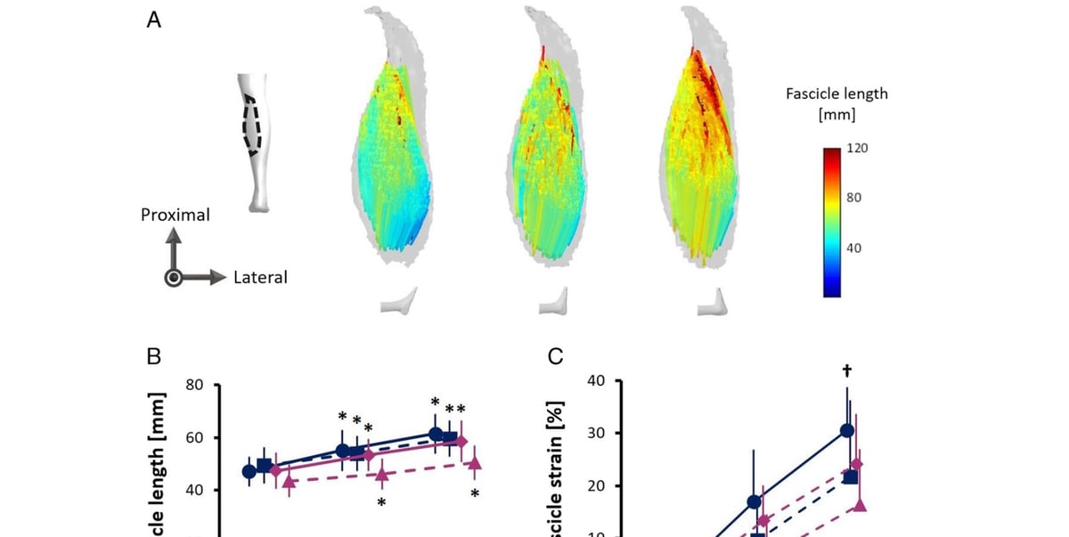 Groundbreaking Study Reveals Fascicle Dynamics in Muscle Elongation