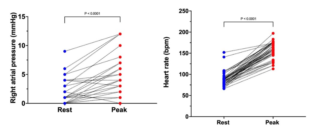 New Study Helps Explain Post-COVID Exercise Intolerance